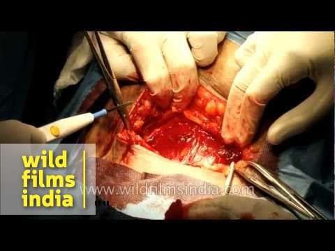 Human birth taking place, on camera!