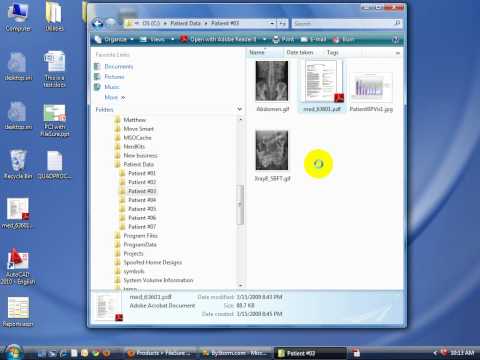 HIPAA and FileSure - Auditing access to personal health information