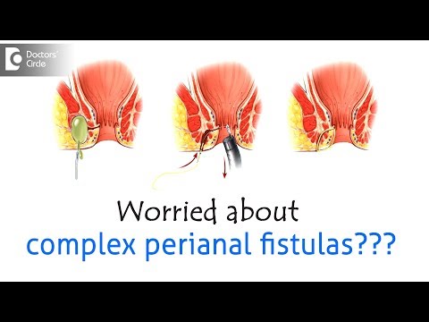 What is the treatment complex perianal fistulas? - Dr. Rajasekhar M R