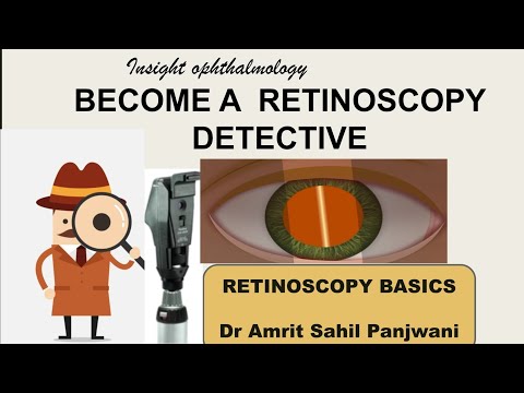 Important Concepts in RETINOSCOPY!