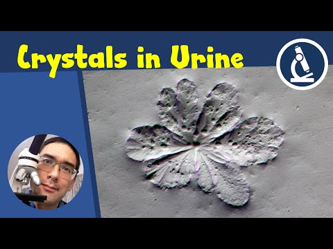 🔬 141 - How to observe URINE under the microscope | Amateur Science