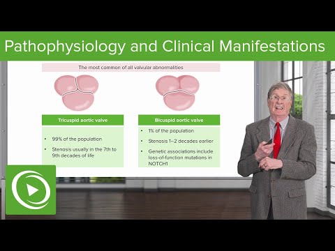 Calcific Aortic Stenosis - Pathophysiology and Clinical Manifestations