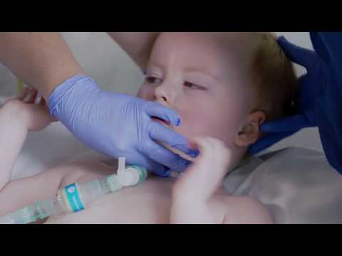 Changing a Tube on a Ventilated Child