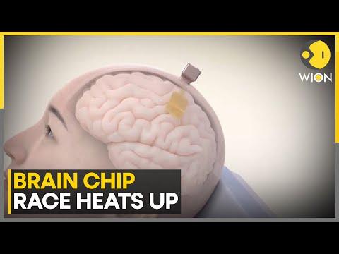 Brain Implants The Future Of Computing? China Aiming For Brain Chip Lead | World News | WION