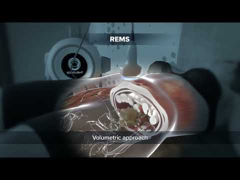 Differences between R.E.M.S. Technology and DEXA