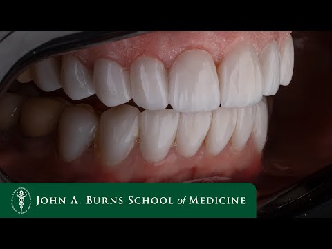 Periodontal Disease, by Patel, DDM