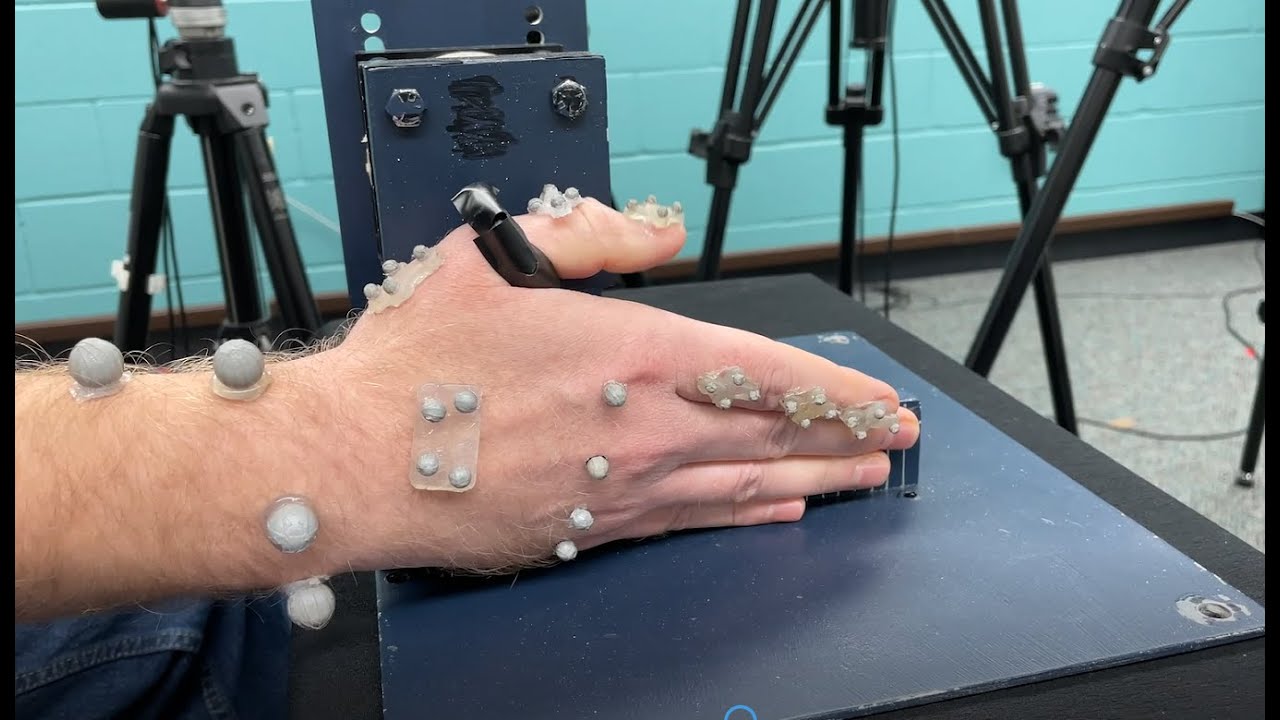 3D Technology Looks for Osteoarthritis