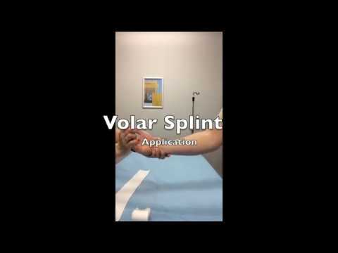 Volar splint