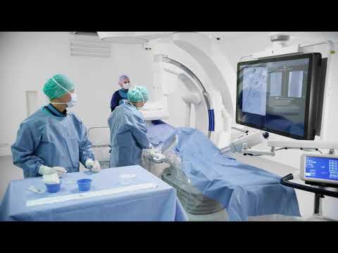 Simplifying and advancing 3D imaging with SmartCT in prostate artery embolization