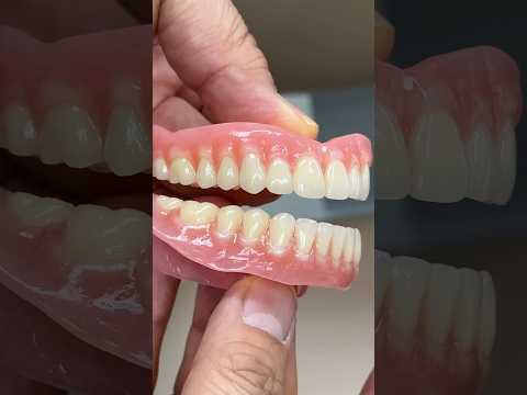 Magnificent Process Dentures #lsk121shorts #teeth #dental