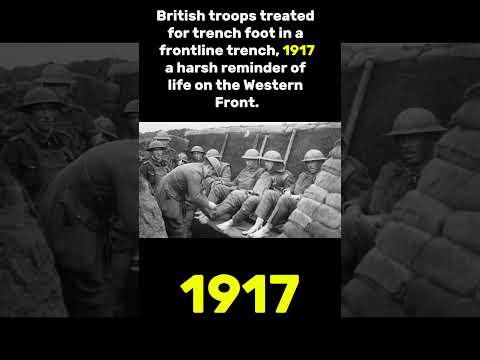WWI: British Soldiers Treated for Trench Foot in the Trenches (1917)