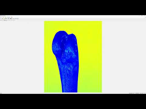 Femur Images: Jet Colormap Image Set