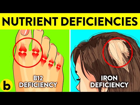 7 Incredibly Common Nutrient Deficiencies
