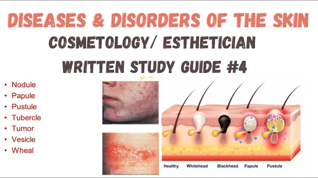 Cosmetology Written Study Guide #4 | Diseases and Disorders of the Skin