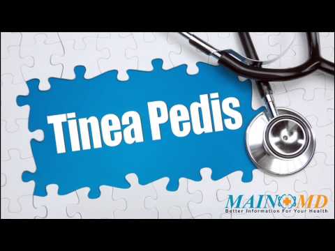 Tinea Pedis ¦ Treatment and Symptoms