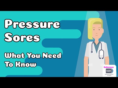 Pressure Sores - What You Need To Know