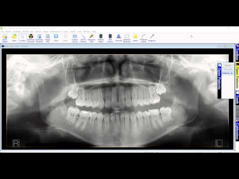 How to move an image to the correct patient chart
