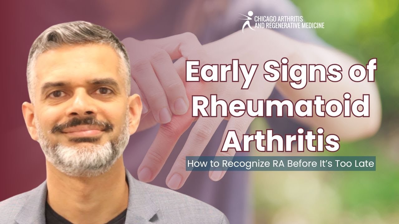 Early Signs of Rheumatoid Arthritis: How to Recognize RA Before It’s ...