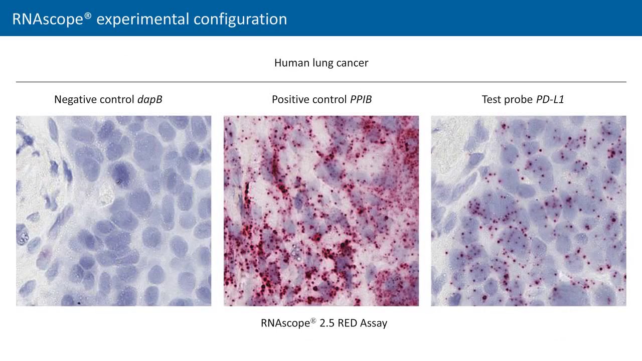 Characterization of immune checkpoint expression & infiltrating immune cells in TME by RNAscope ISH