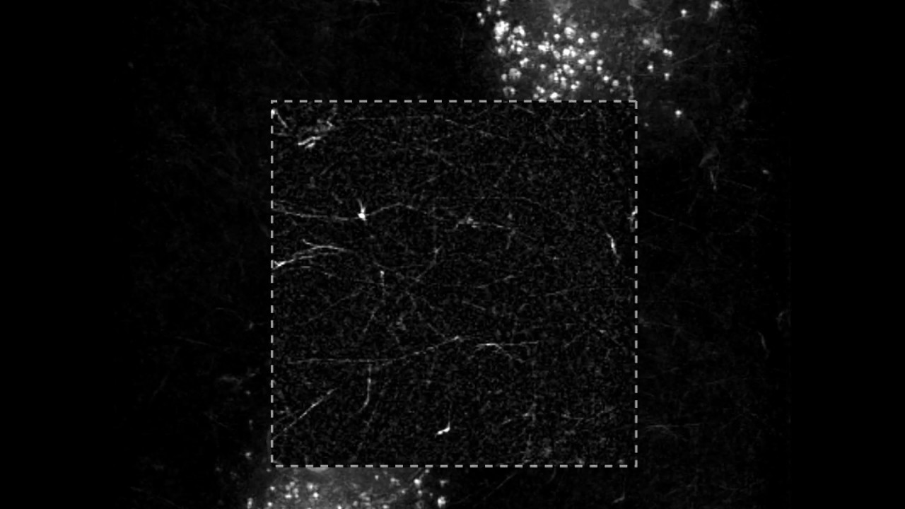 Marker-free visualization of fibrin network formation by MDA-MB-231 cells