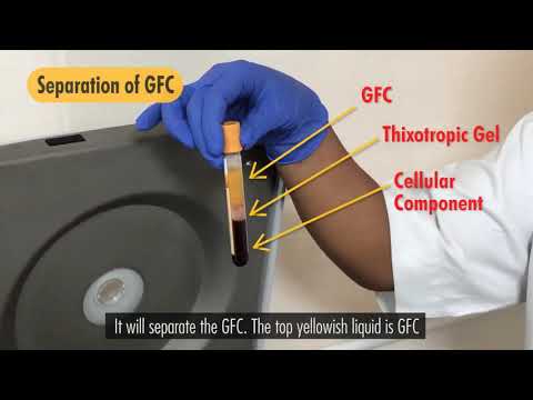 GFC Kit - Growth Factor Concentrate Kit Latest Price, Manufacturers ...