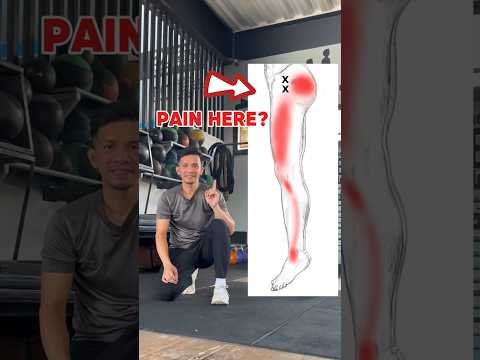 ILIOTIBIAL BAND SYNDROME PAIN RELIEF!! 🤩🤩🤩 #itbs #kneepain #hippainrelief #trending