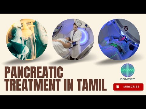 Pancreatic Treatment in Tamil | Dr.Ravindran Kumeran | Admert Medical Centre #pancreas #cancer