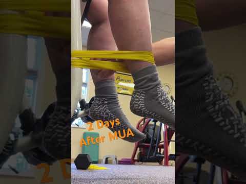 2 Days After MUA | Total Knee Replacement Series