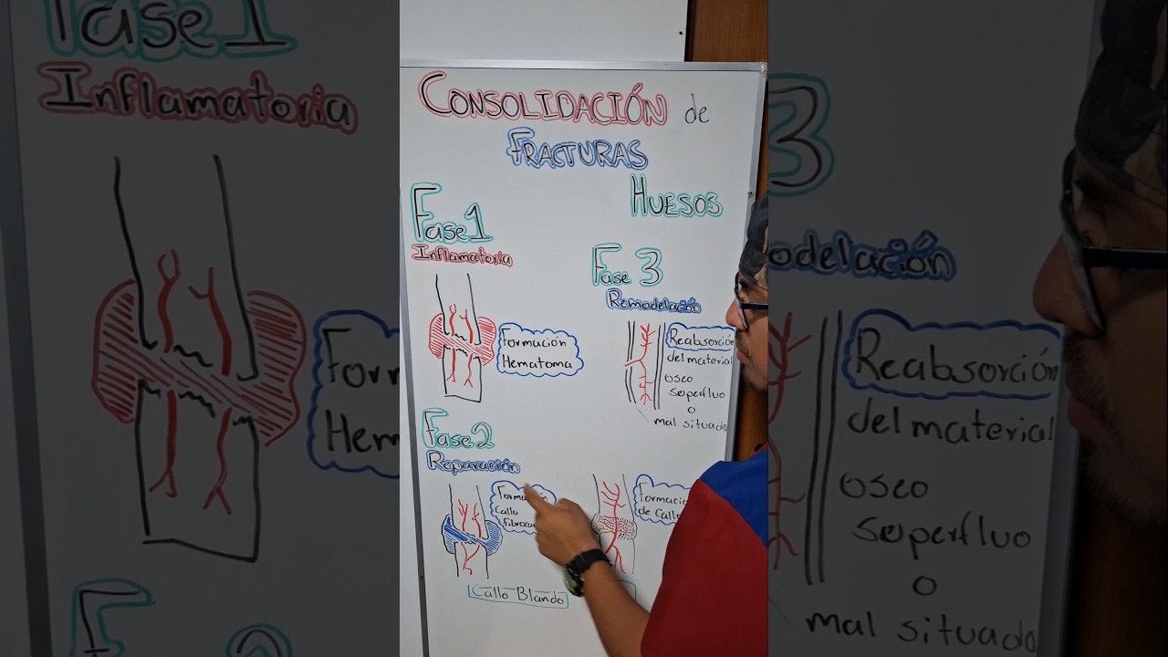 CONSOLIDATION of FRACTURES/BONES 🦴 #emvz #mvz #students #bajavets #animal #animalsoftiktok