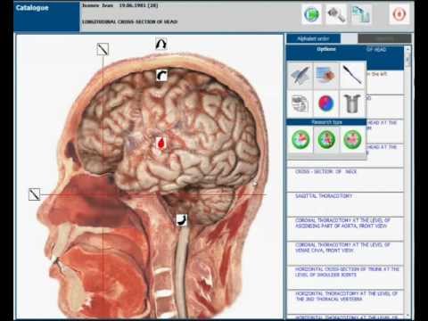 Biospect 21 | Bioscanner: Oberon - Introspect - Biospect