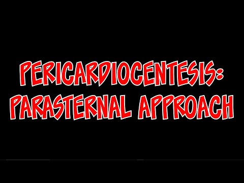PERFORMING PERICARDIOCENTESIS USING PARASTERNAL APPROACH