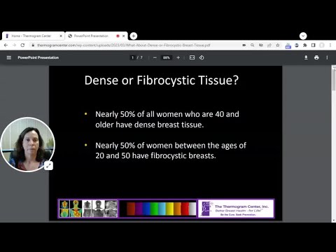 Dense or Fibrocystic Breast Tissue?