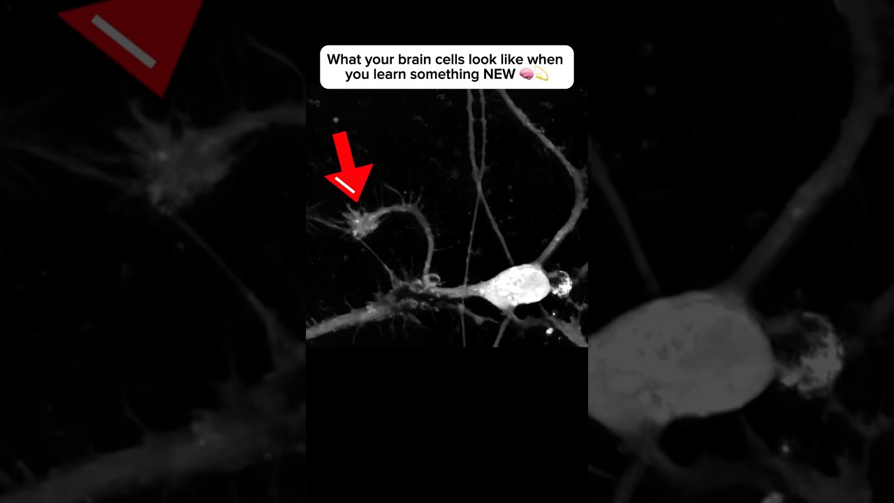 Brain cell restructures itself after forming a new connection #neuroplasticity #neuroscience #brain