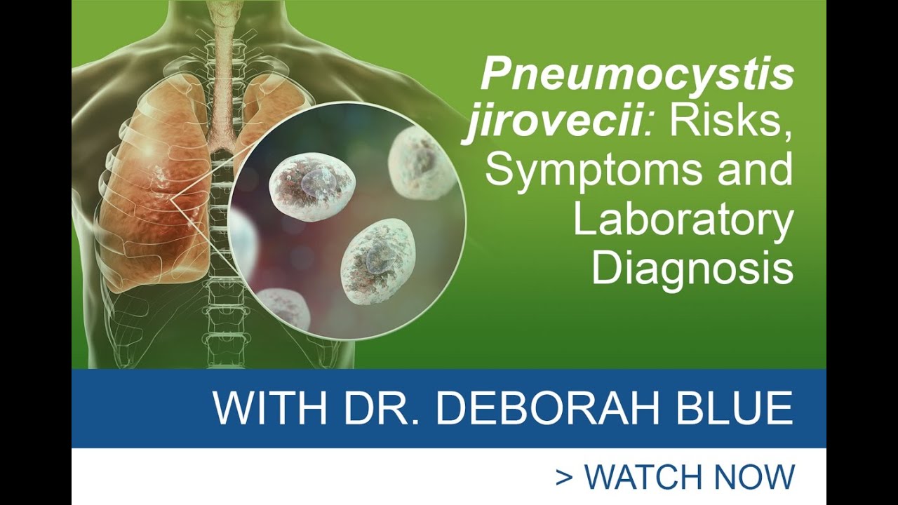 Pneumocystis Jirovecii: Risks, Symptoms & Laboratory Diagnosis | Dr. Deborah Blue