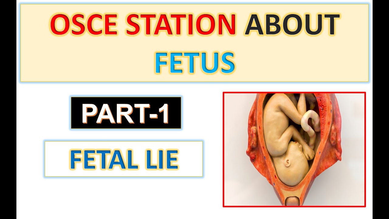 FETUS RELATIONSHIPS IN UTERUS AND BASIC TERMINOLOGIES  PART 1 |FETAL LIE  | OSCE STATION