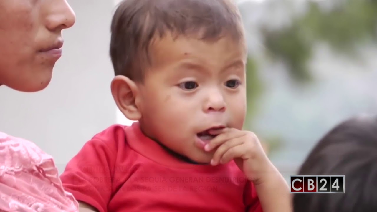 Pobreza y sequía generan desnutrición crónica en Centroamérica