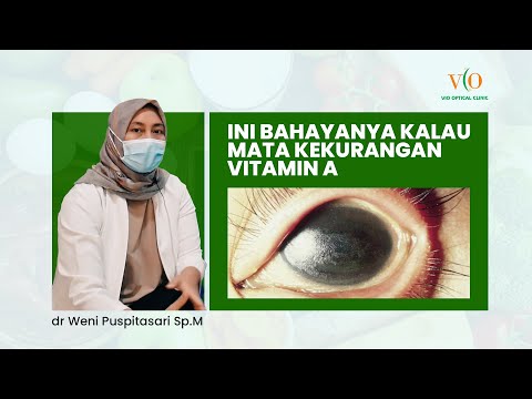 BAHAYA KEKURANGAN VITAMIN A PADA MATA - XEROPHTHALMIA