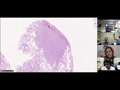 Fresh Air with Sanjay and Matt. Episode 10: A "Spot Diagnosis", "Spotter" or "Augenblick"