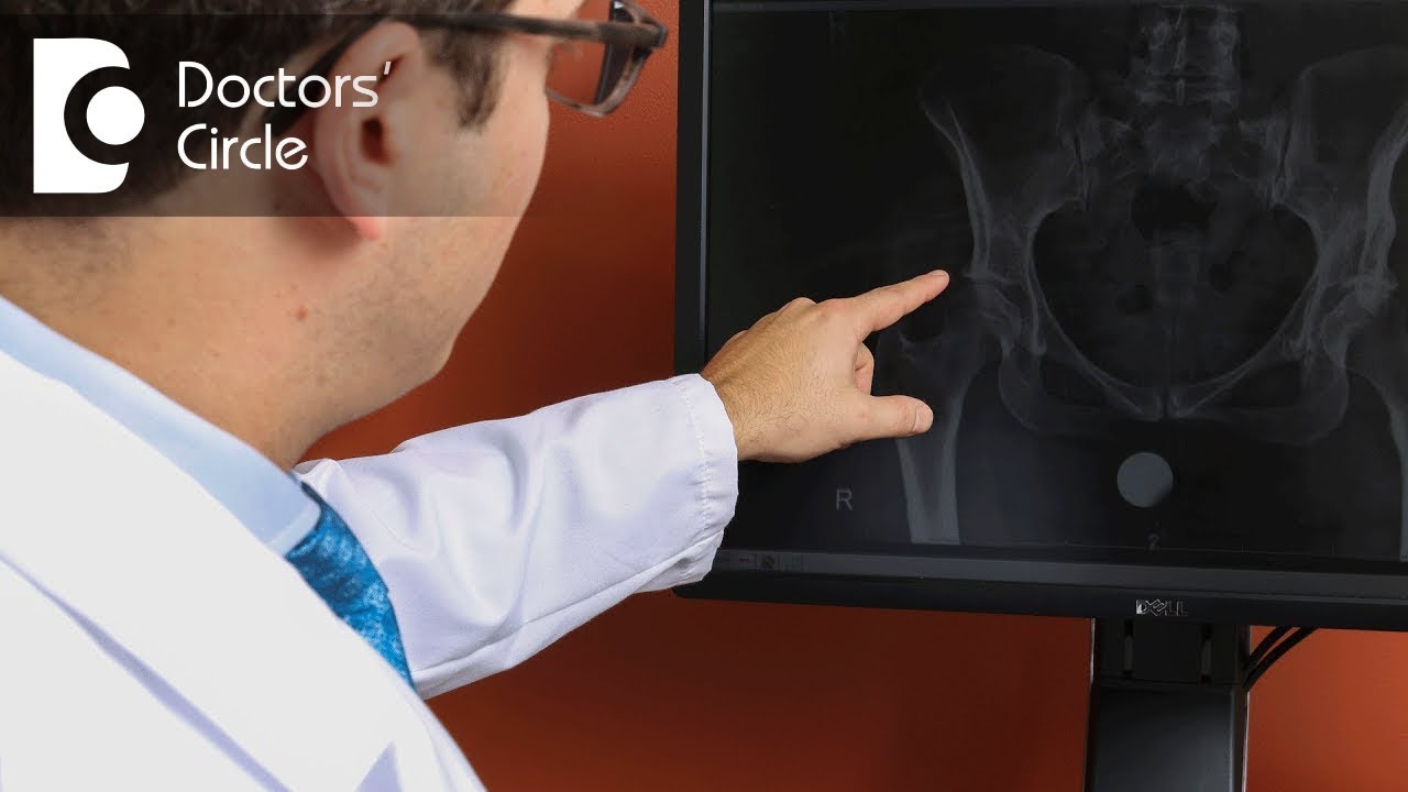What are surgical challenges in Complex Primary Total Hip Arthroplasty? - Dr. Suresh Annamalai