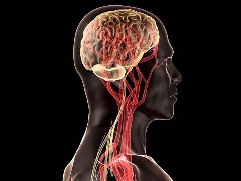 Temporal Arteritis