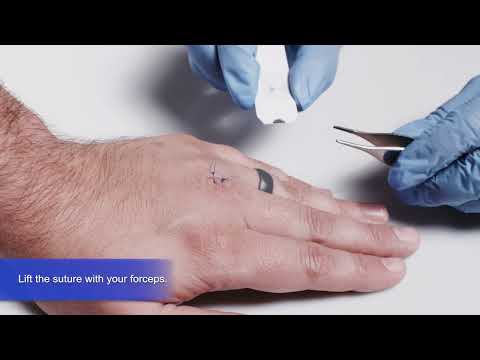 How-To: The Bionix SutureOut® Suture Removal Tool