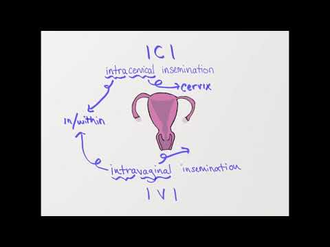 What is ICI? (Intracervical insemination)