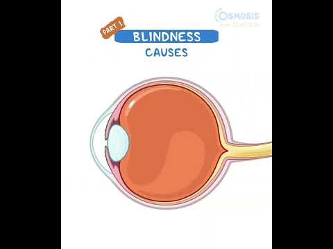 Blindness