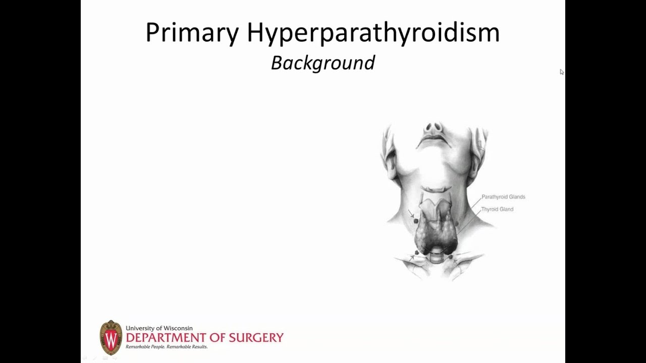 At the Forefront: Parathyroid Disease Treatment