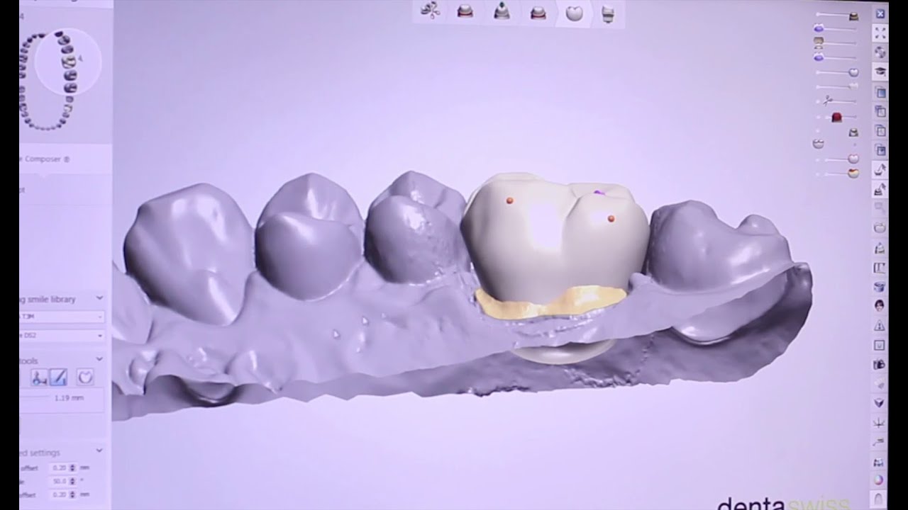 The Digital Workflow