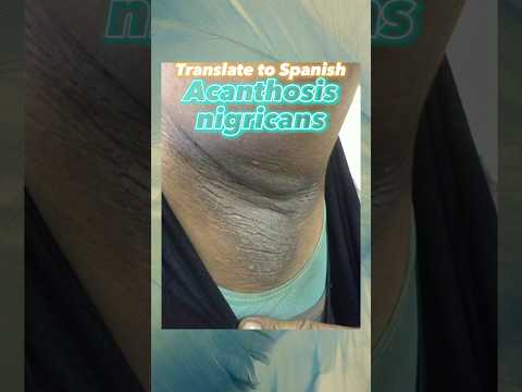 ACANTHOSIS NIGRICANS Translate to SPANISH | Medical Interpreter Training - Work Vocabulary