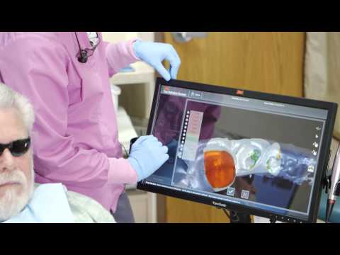 Dr. Sengbusch Reviews the 3M True Definition Scanner & Lava Plus