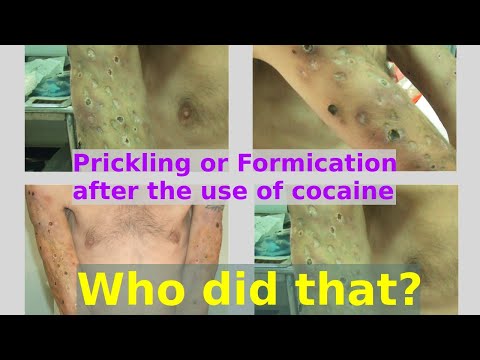 formication