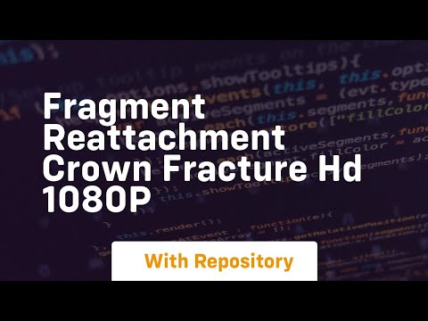Fragment reattachment crown fracture hd 1080p