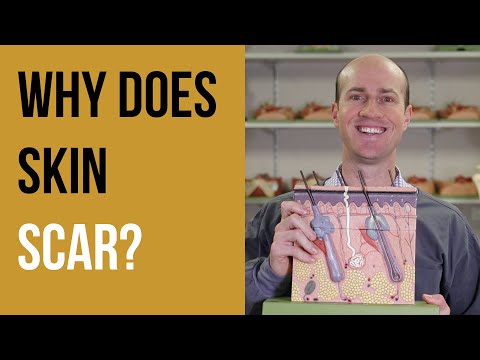 Why does skin SCAR? What is a scar and why does scar tissue look different?